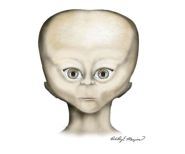 The Starchild Skull – Mexico Unexplained