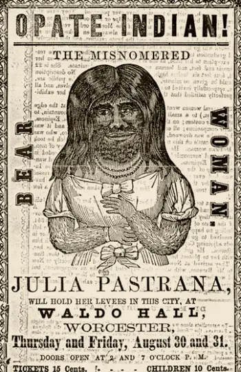 Julia Pastrana, Mexico’s “Ape Woman” – Mexico Unexplained
